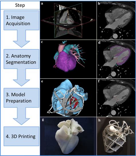 Basic Steps In The Cardiovascular 3D Printing Process A B Volumetric