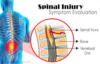 Spinal Injury Symptom Evaluation
