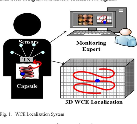 figure 1 from wireless capsule endoscopy using localization techniques over imu sensor and side