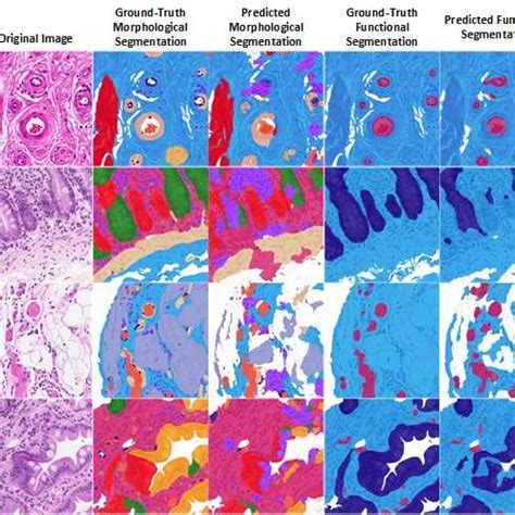Histosegnet Performance On Whole Slide Image Wsi Segmentation
