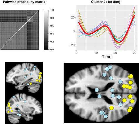 parameter clustering in bayesian functional principal component analysis of neuroscientific data