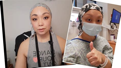 Week Recovery Bilateral Mastectomy With Chest Expanders Youtube