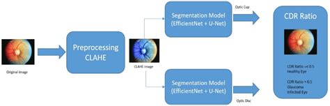 a proposed framework for glaucoma detection using efficientnet models download scientific diagram