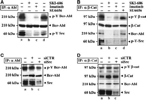 Tyrosine Kinase Activity Of Bcr Abl Is Required To Trigger B Catenin Y