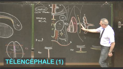 Anatomie Des Noyaux Basaux Et Substance Blanche T Lenc Phalique