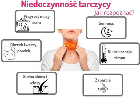 Niedoczynność tarczycy jak wyleczyć ZDJĘCIA