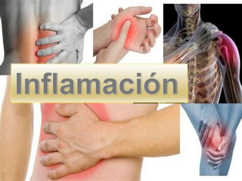 Inflamaci N Dra Xmed Udocz