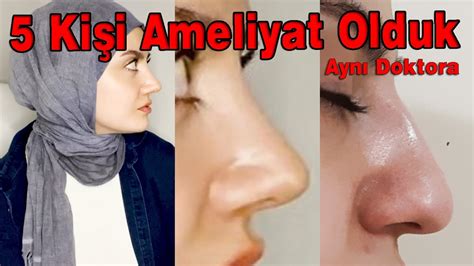 Burun Ameliyatı Sürecim Hakkında Soru Cevap YouTube