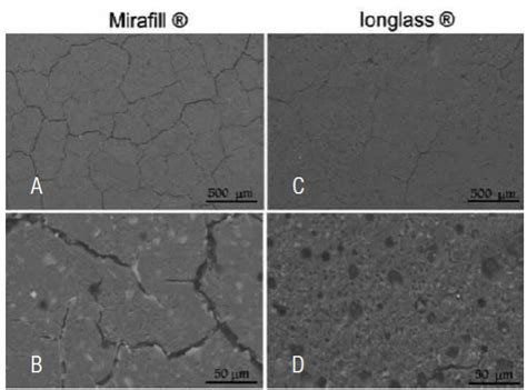 Effect Of Ions Released And PH Of Two Glass Ionomer Cements In Human
