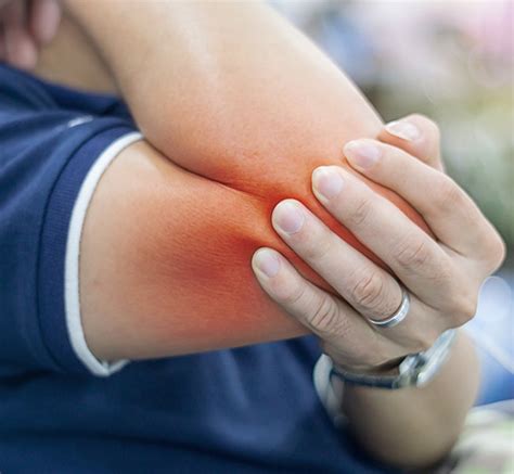 Tennis Elbow Aka Lateral Epicondylitis JNU Hospital