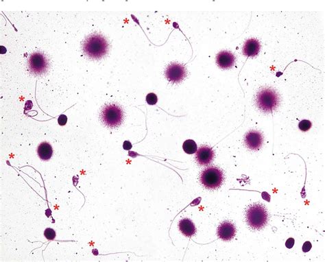 figure 2 from simple determination of human sperm dna fragmentation with an improved sperm