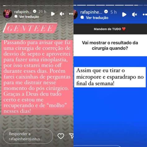 Rafaella Justus faz plástica no nariz e fala sobre recuperação