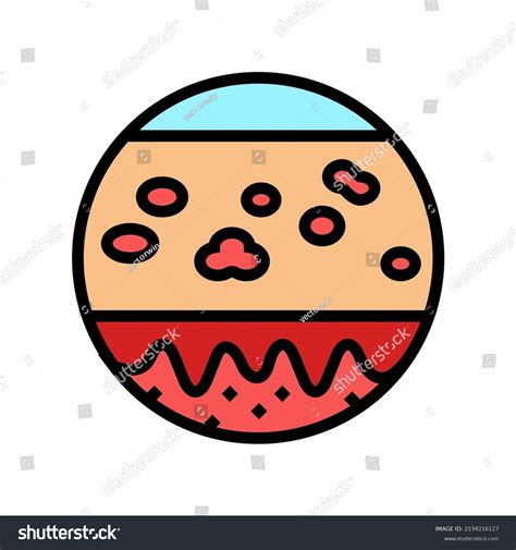 Skin Rashes Hiv Symptom Color Icon Stock Vector Royalty Free