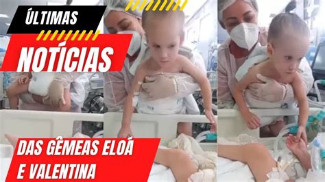 ÚLTIMAS NOTÍCIAS DAS GÊMEAS ELOÁ E VALENTINA DEUS É PERFEITO