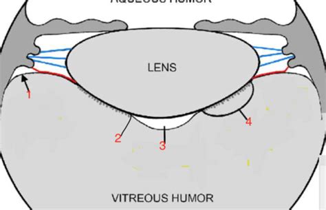 Opt Mt The Crystalline Lens Flashcards Quizlet