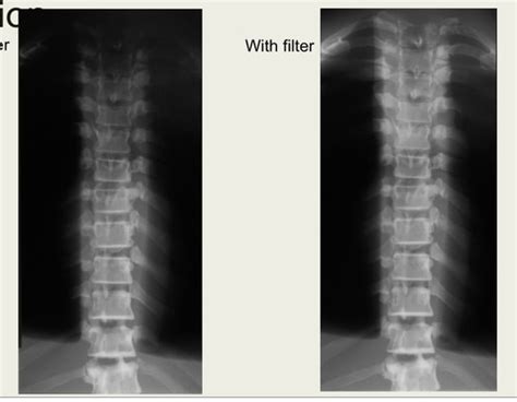 Digital Radiography Final Flashcards Quizlet