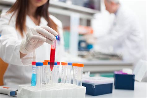 AIDS a che punto è la ricerca Deabyday