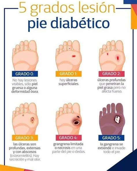 Grados de lesión en pie diabético Auxiliar de enfermeria Medicina de