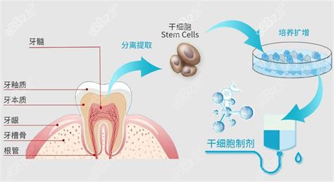 细胞再生牙 自体牙移植和种植牙哪个好还不贵 我推荐种植牙 种植牙 8682整形网