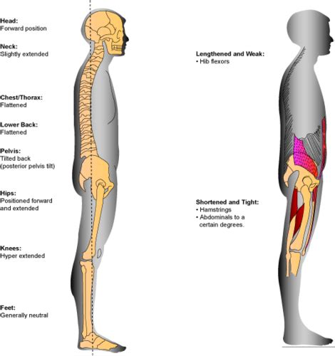 Posture Assessment Flashcards Quizlet