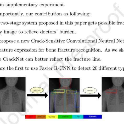 pdf bone fracture detection through the two stage system of crack sensitive convolutional