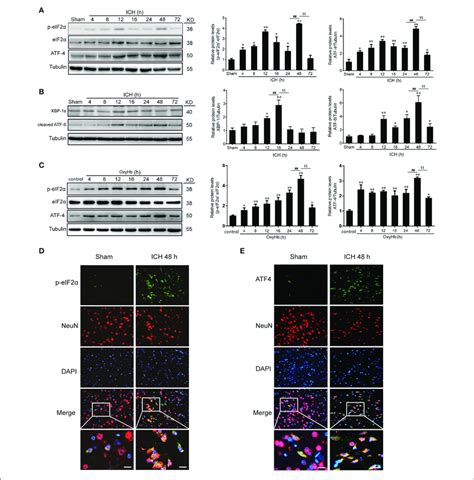 p eIF2α and ATF4 protein levels are increased after ICH in vitro and