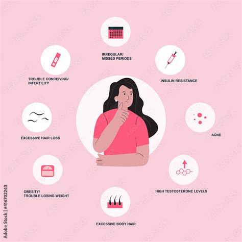 PCOS Or Polycystic Ovary Syndrome Symptoms Infographic Stock Vector