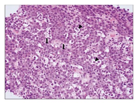 High Power Photomicrograph Of A Hematoxylin And Eosin H E Stained