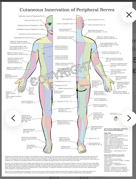Dermatomes Myotomes And Dtr Poster 20 X 30 Chiropractic Etsy Artofit