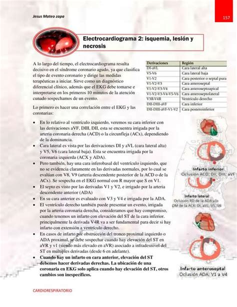 Electrocardiograma 2 isquemia lesión y necrosis jesus mateo zapa