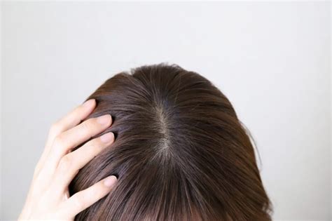 女性の薄毛を改善する食べ物はご存知ですか食品や栄養素についても解説 メディカルドック
