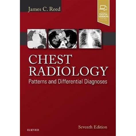 Chest Radiology