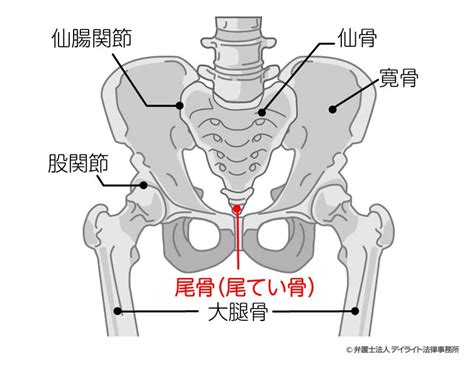 尾てい骨骨折とは対処法や後遺症のポイント 交通事故の相談はデイライト法律事務所