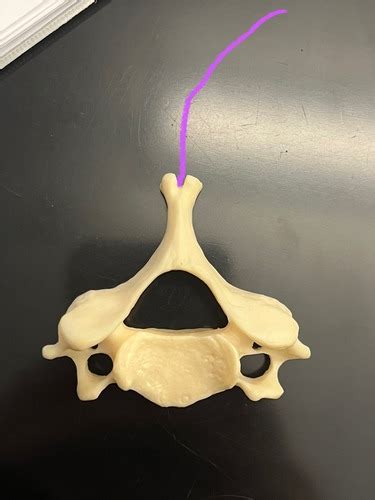 Cervical Vertebrae Flashcards Quizlet