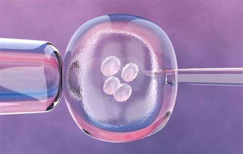 ℹ Fecundación in vitro conoce el procedimiento