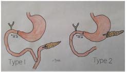 SciELO Brasil IS THE ANATOMICAL SEQUENCE OF GASTRIC AND BILIARY