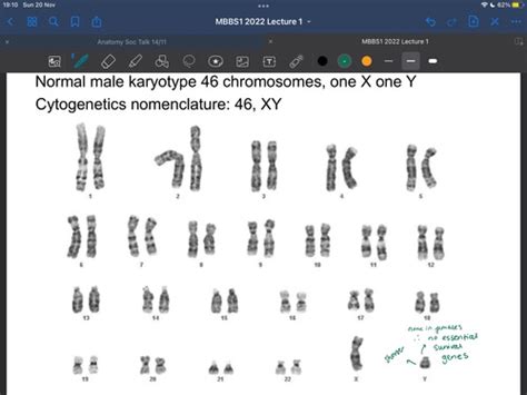Mcg Basics Of Genetic Inheritance Flashcards Quizlet