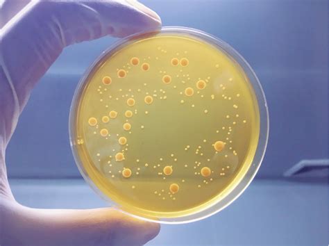 Tipos De Agar En Microbiolog A Un An Lisis Detallado Y Aplicaciones