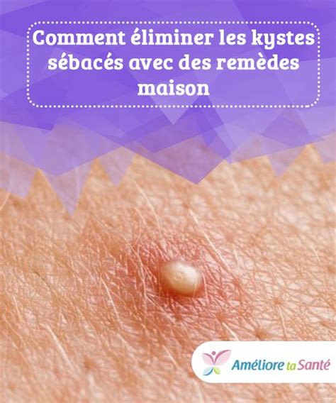 Comment éliminer les kystes sébacés avec des remèdes maison