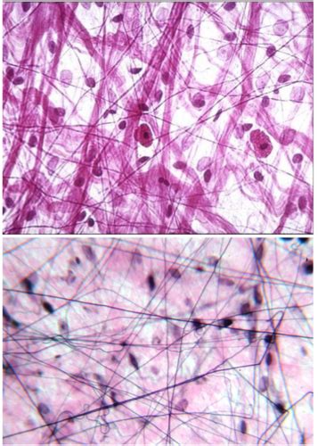 Lab Connective Tissue Flashcards Quizlet