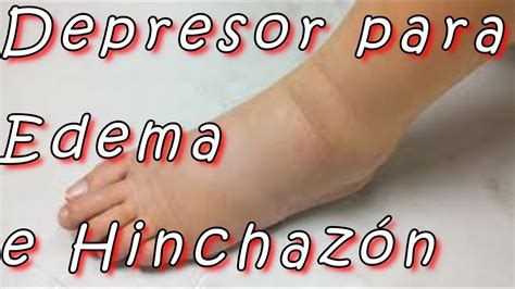 Pies Y Piernas Hinchados Reducir Los Edemas Y La Hinchaz N Con