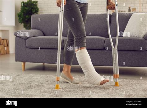 Patient With Broken Leg In Plaster Cast Undergoes Rehabilitation And