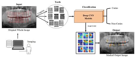diagnostics free full text an explainable deep learning model to prediction dental caries