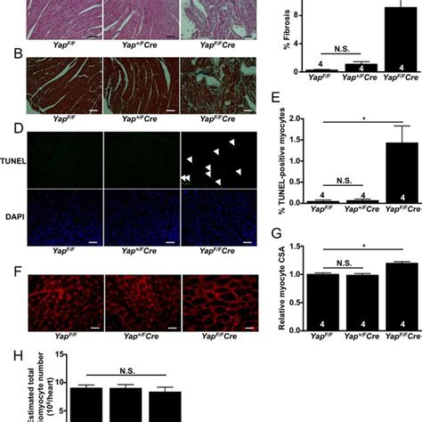 Histological Analysis Of Yap1 Deficient Mice A G Ventricles From