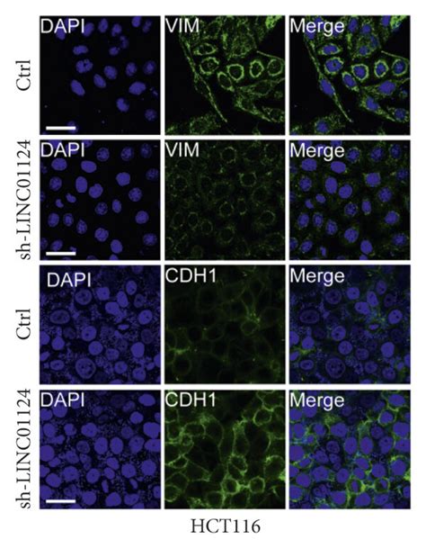 Knockdown Of LINC01124 Inhibited Cell Migration And Invasion A Wound