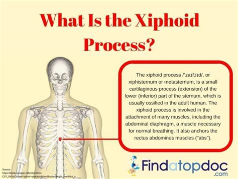 What Is The Xiphoid Process And Symptoms Infographic