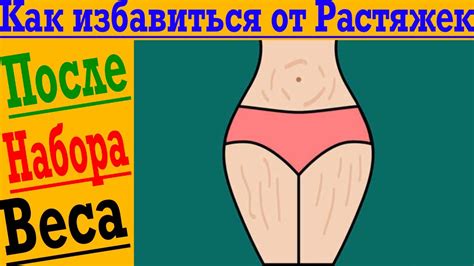 Как избавиться от растяжек на коже YouTube