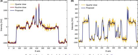 figure 12 from a deep convolutional neural network using directional wavelets for low‐dose x‐ray