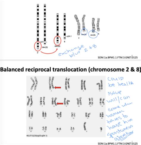 Structural Chromosomal Abnormalities Flashcards Quizlet
