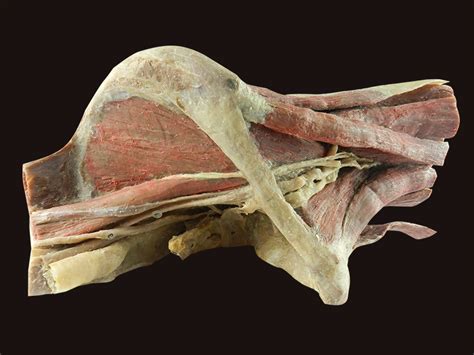 Sagittal Section Of The Female Reproductive System